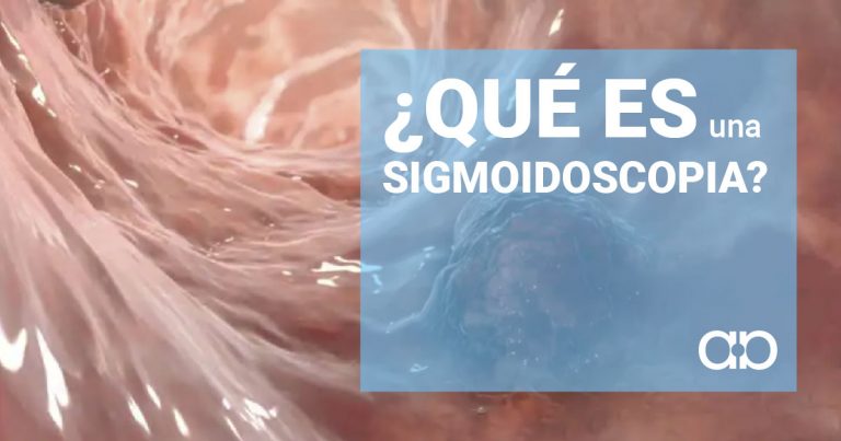 Unidad de Endoscopia - Alberdi Aparato Digestivo